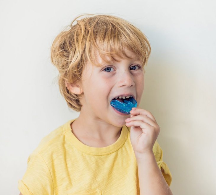 Mouth Guard Union City CA - Union City Pediatric and Adolescent Dentistry